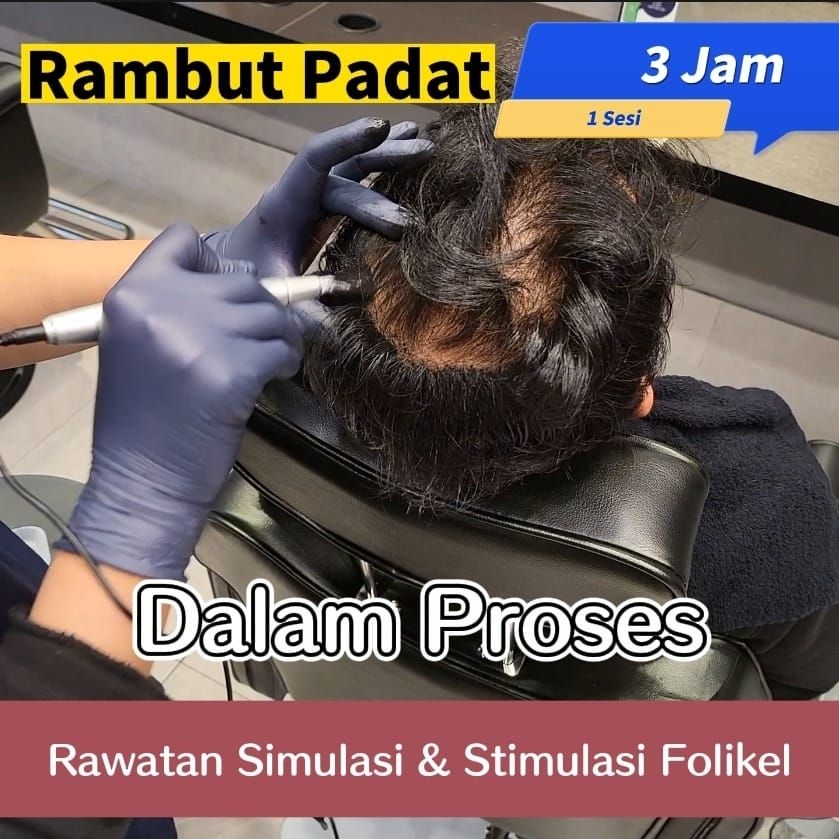 Rawatan Rambut Simulasi & Stimulasi - Pulihkan Masalah Kenipisan ...